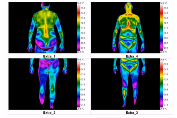 whole_body_thermography_images | The Functional Perspective